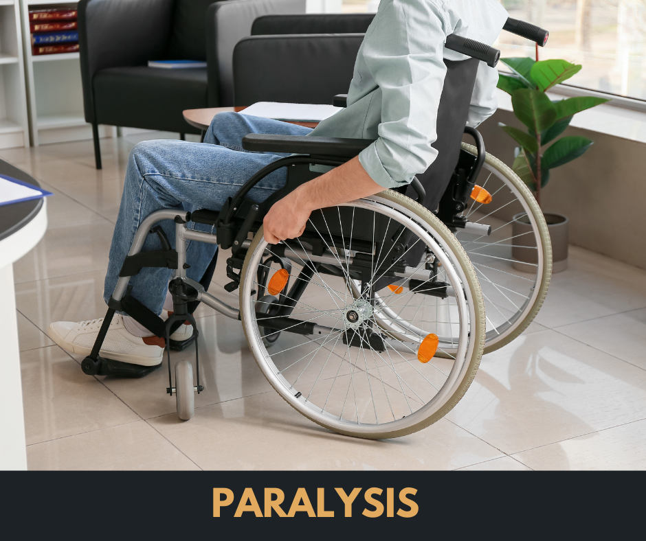 A Deeper Look at Paralysis and Similar Injuries