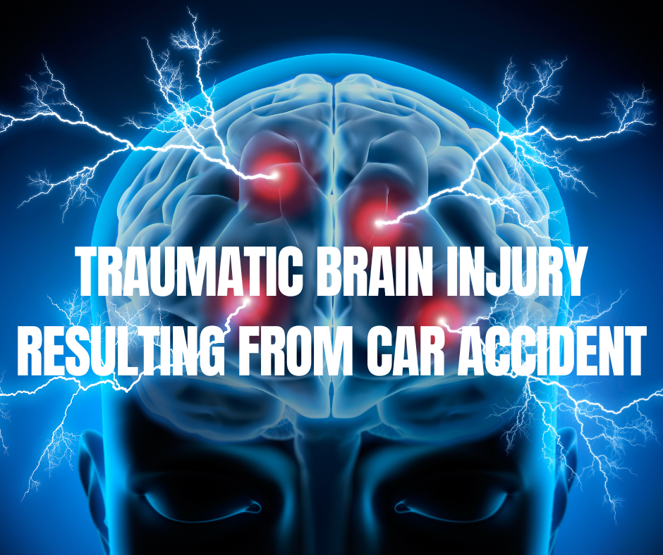 Traumatic Brain Injury Resulting from Car Accidents